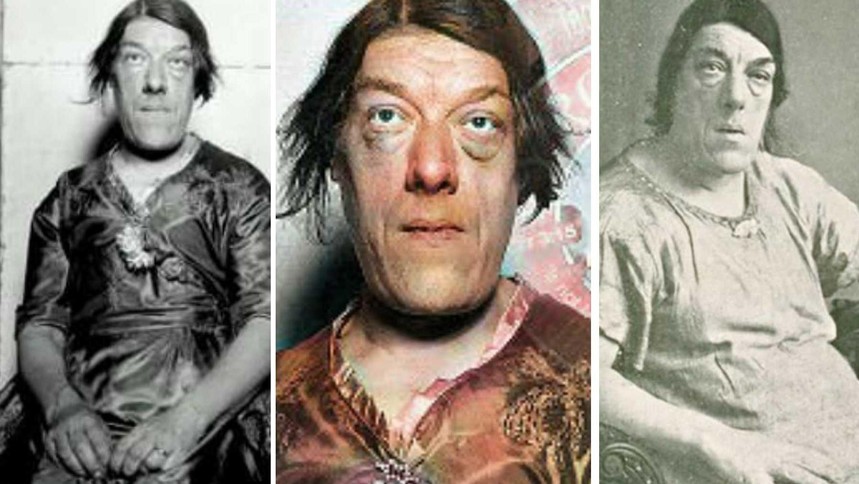 Mary Ann Bevan, najbrzydsza kobieta