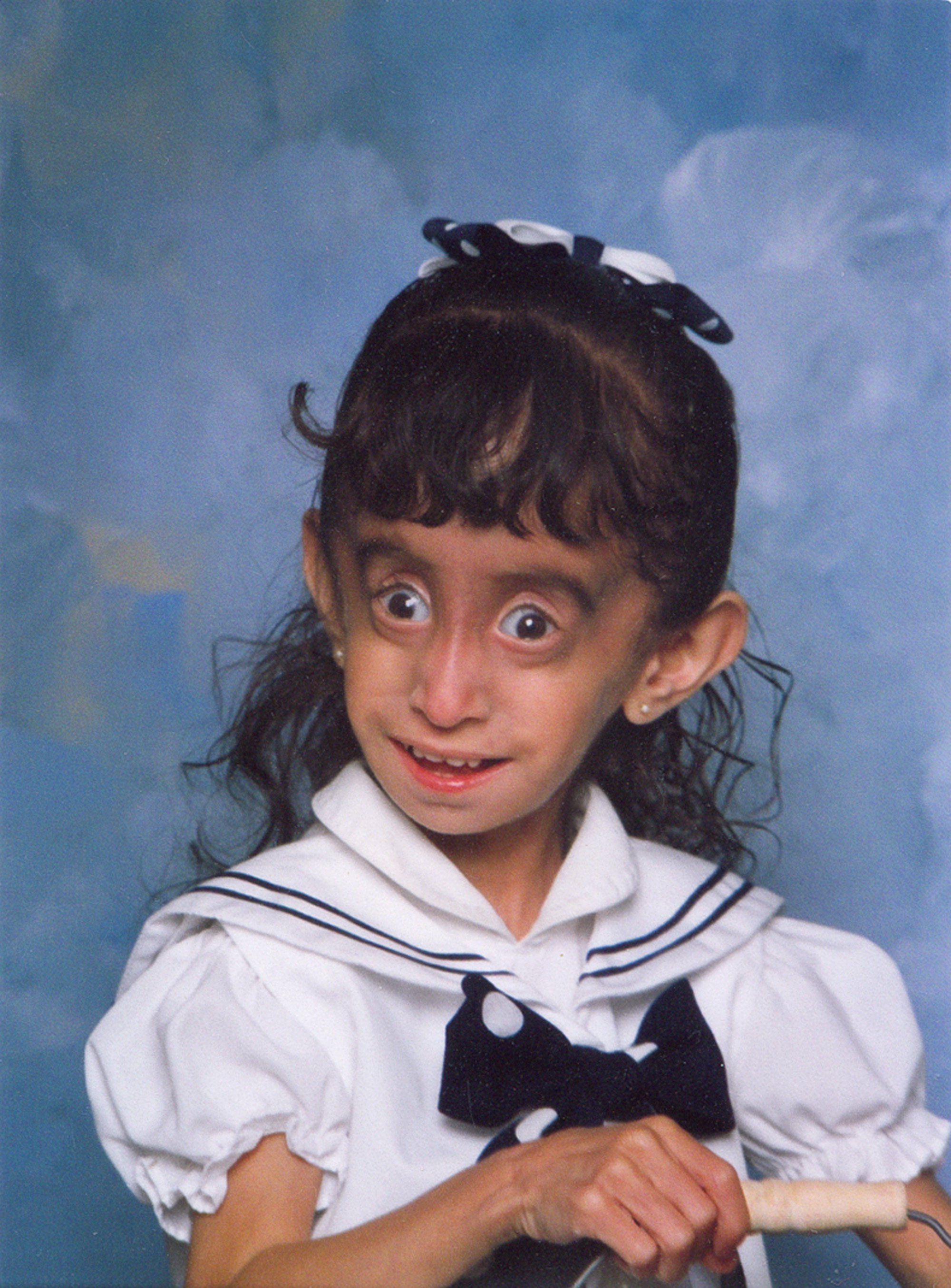 Szívszorító fotók - így változott az évek alatt a világ legcsúnyább ...