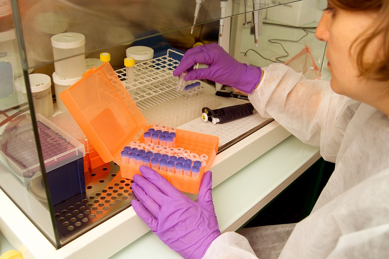 Revolucija u lečenju najagresivnijih tumora - krivac su ehDNK - Žena.rs