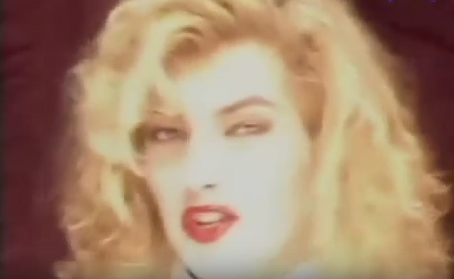 Posle BOTOKSA i operacija lice joj je IZOBLIČENO! Jami više nije onakva ...