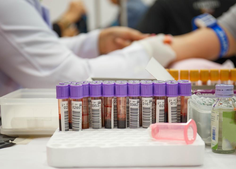 Monocyty - norma, podwyższone (za wysokie, powyżej normy)