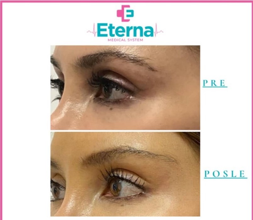 dr Tanja Radenkov poliklinika Eterna - Žena.rs