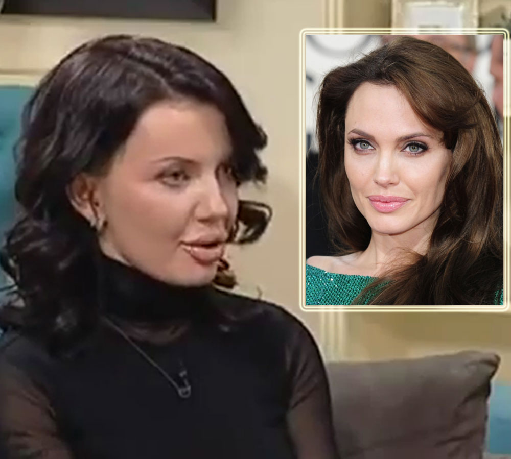 Bosanka uz pomoć plastičnih operacija postaje Andželina Žoli - Žena.rs