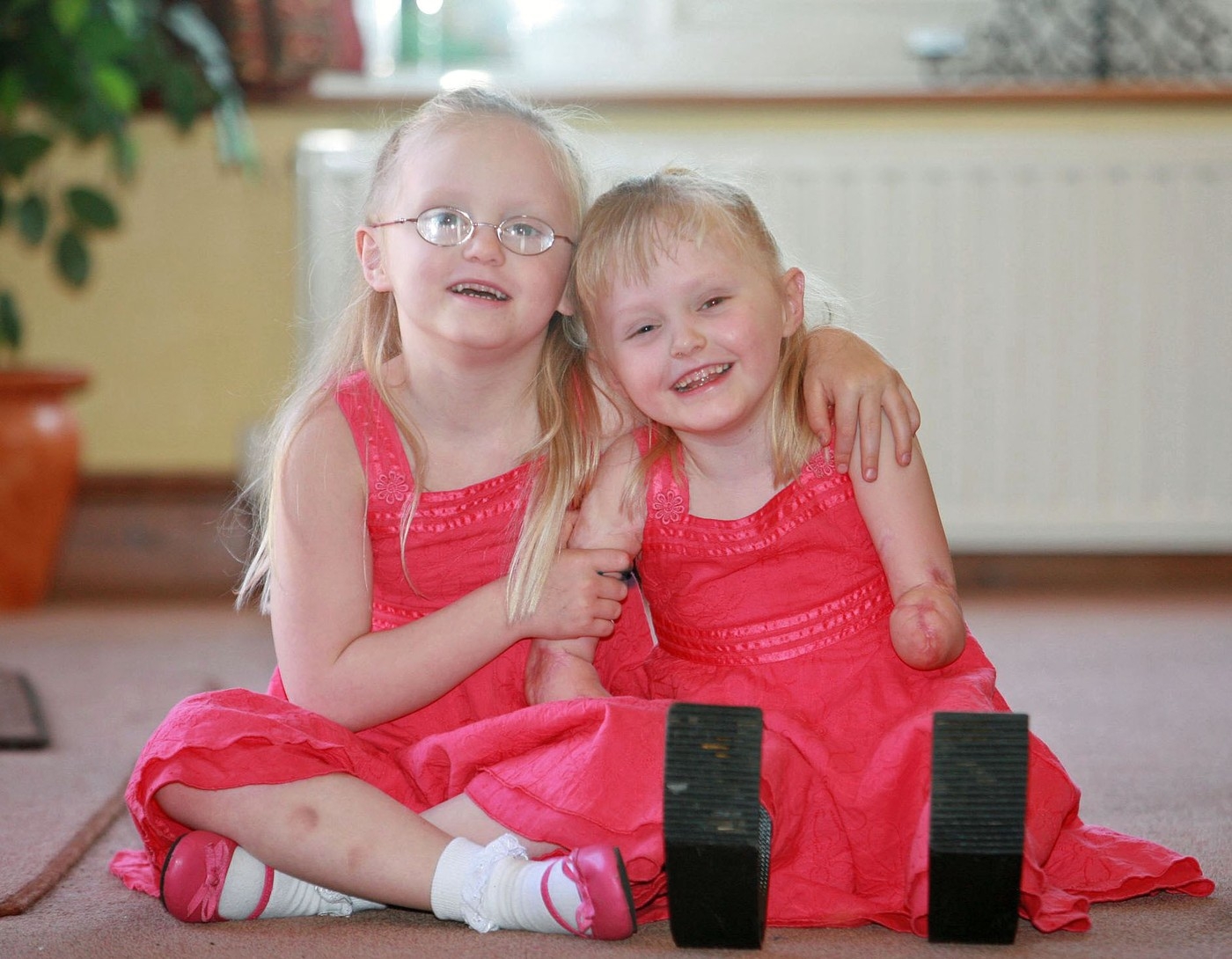 Ova devojčica je zbog bolesti izgubila ruke i noge, sestra bliznakinja ...