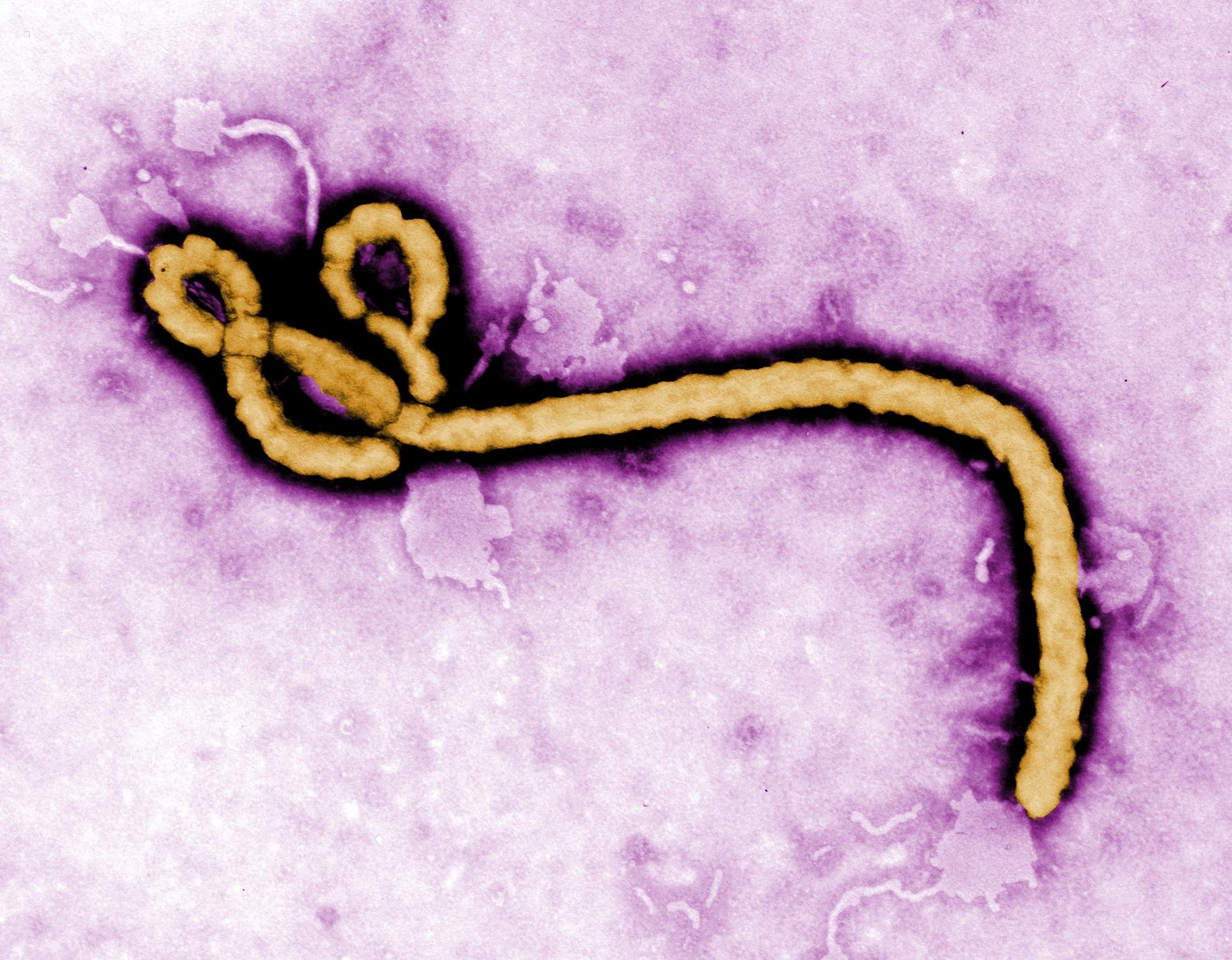 Najgroźniejsze choroby świata epidemie cholera dżuma ebola - Newsweek ...