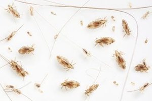 Wszy i Gnidy! Pomóż! - Zapytaj.onet.pl
