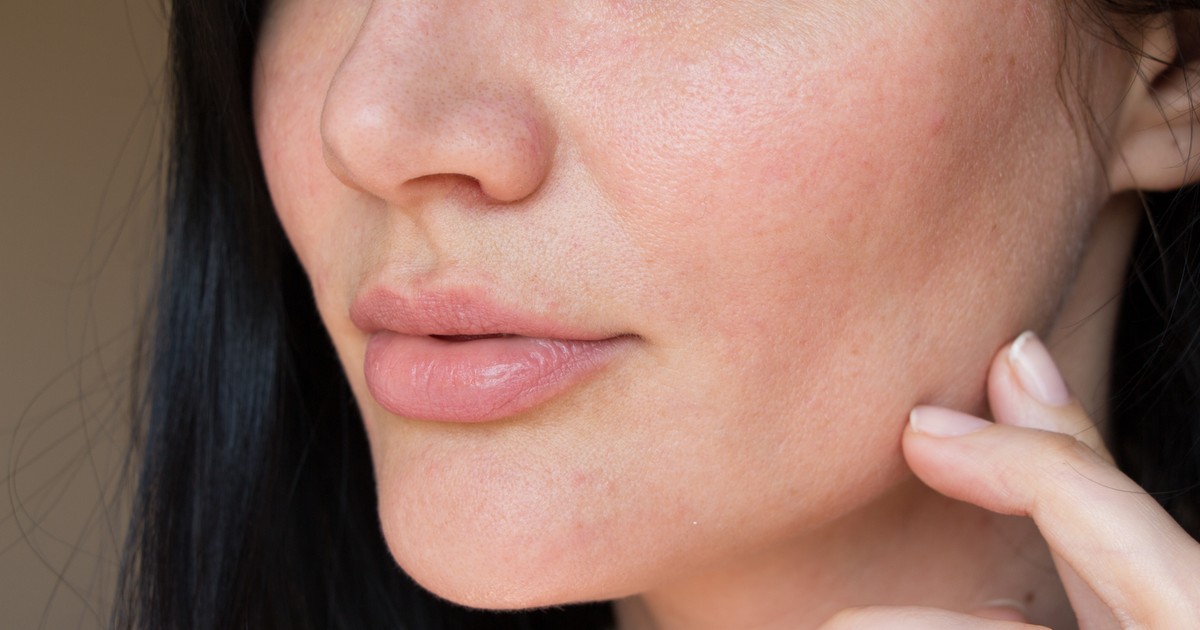 Sebum - co to jest? Czym charakteryzuje się nadmiar sebum?