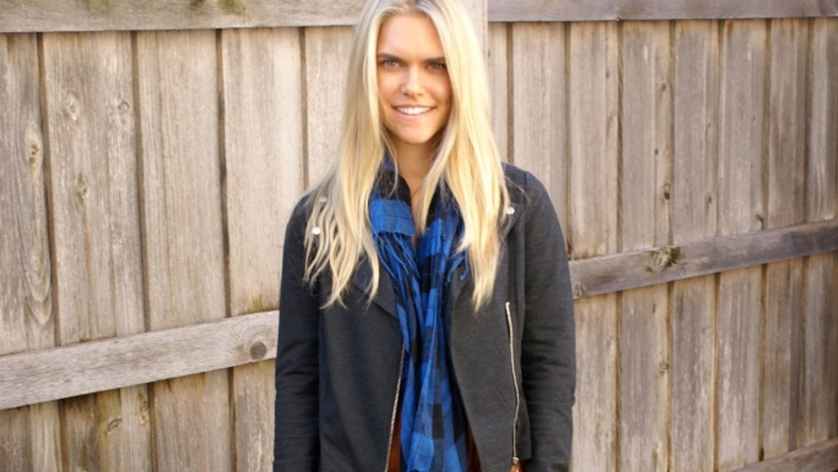 Znana amerykańska modelka i blogerka straciła rękę i oko! - Plejada.pl