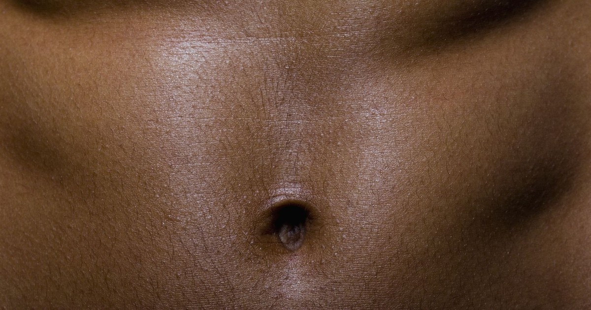 Watch Dr. Pimple Popper Remove a Sticky 'Belly Button' Blackhead ...