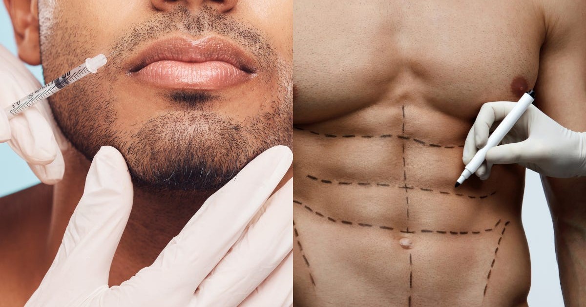 A Miami plastic surgeon reveals the top plastic surgery trends for men ...
