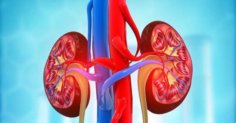 Rak nerki - przyczyny, objawy, leczenie