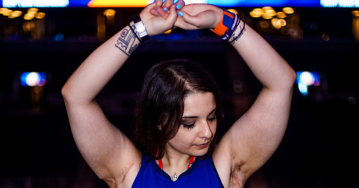 A woman thought the painful bumps under her arms were acne. It took ...