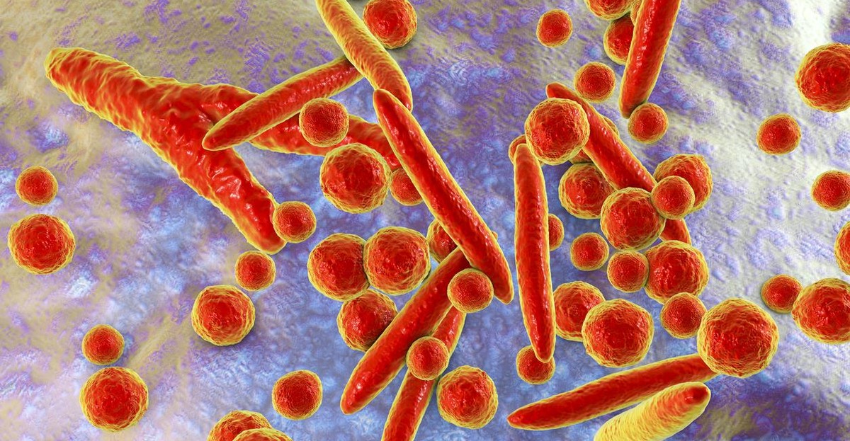 Mykoplazma - objawy infekcji, diagnostyka, jak wyleczyć
