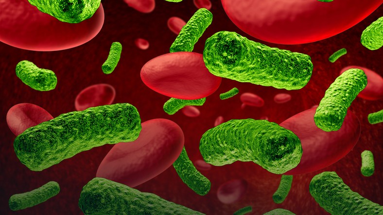 Sepsa (posocznica), a bakteriemia - Dziecko