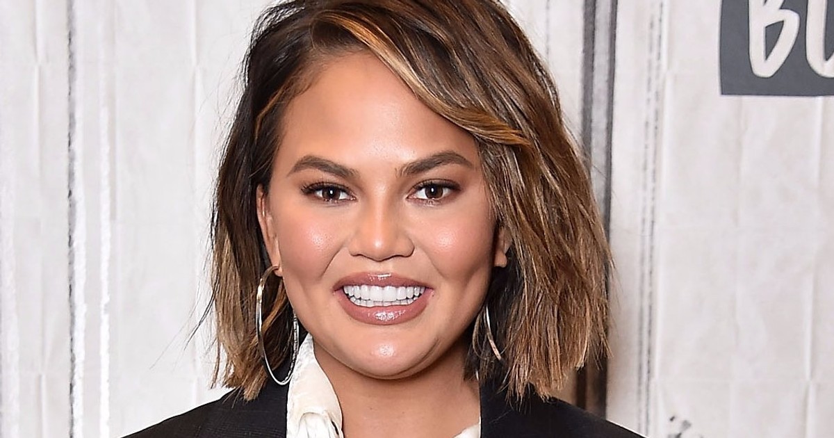 Chrissy Teigen's son Miles is going through helmet therapy. Here's what ...