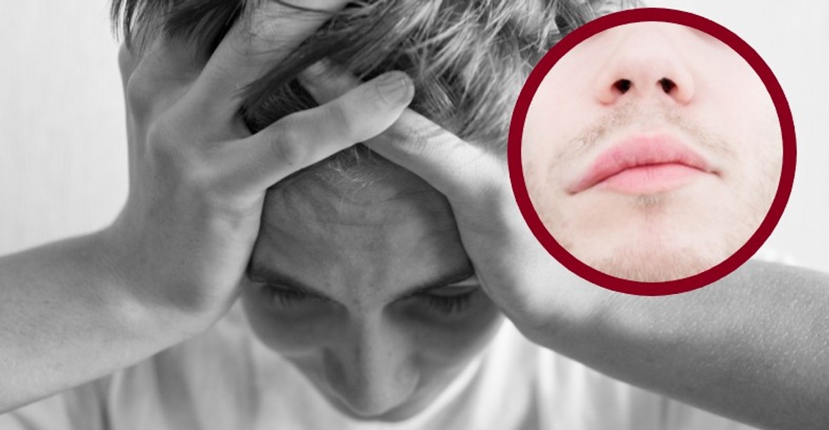 Jeden z pierwszych sygnałów udaru. Pojawia się na twarzy. Patrz na usta