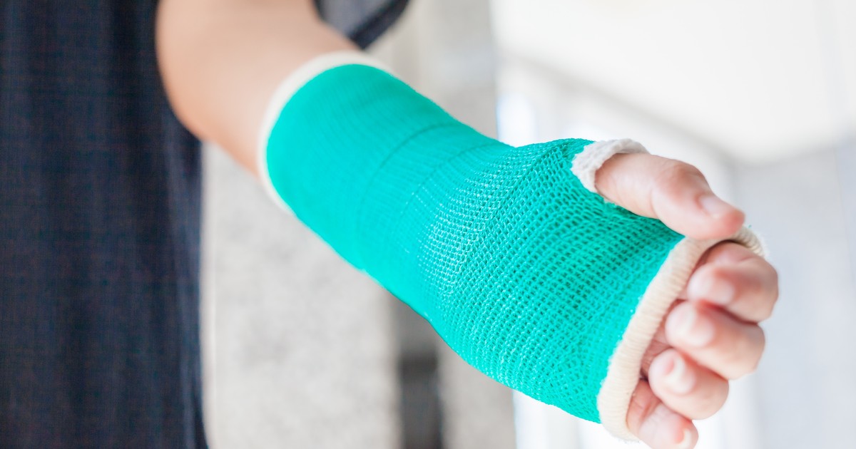 Złamałeś rękę? Naukowcy podadzą ci jointa