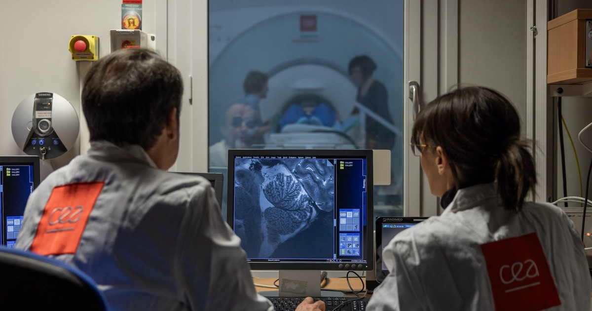 Researchers used the world's most powerful MRI to get brain scans that ...