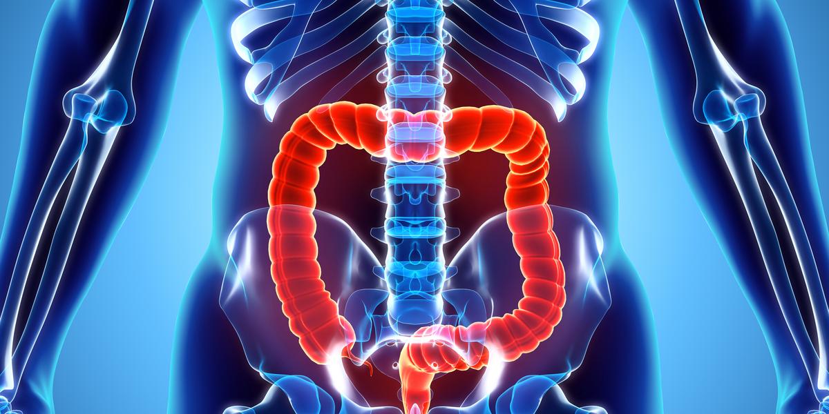 Polipy jelita grubego - towarzyszą im uporczywe gazy, biegunki i ...