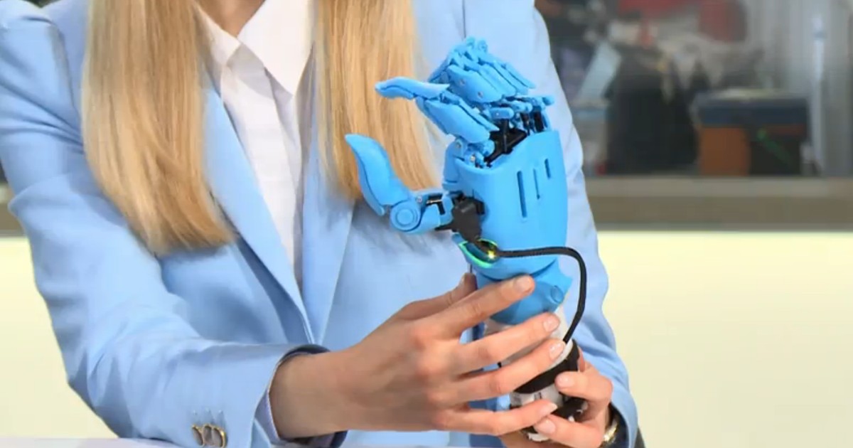 Bioniczna ręka vBionic