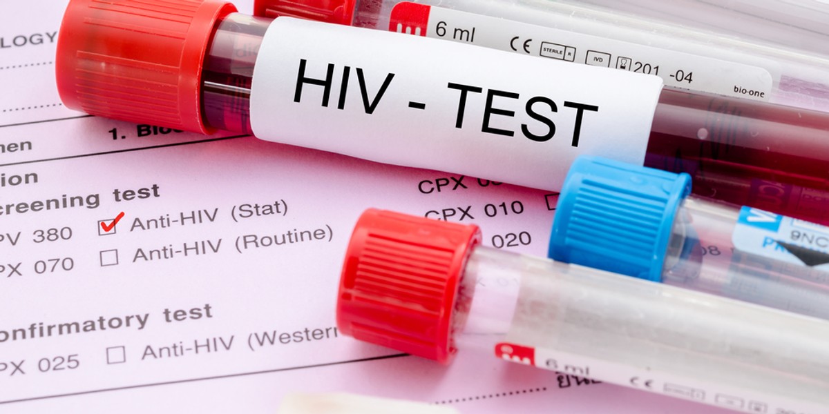 Wirus HIV - objawy, badanie i test na HIV. Jak można się zarazić? - Zdrowie