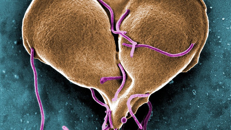 Lamblioza, czyli giardioza - Zdrowie