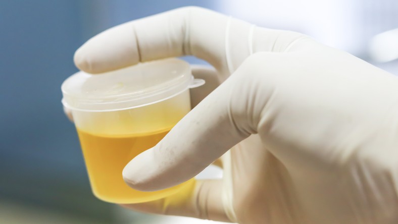 Azotyny w moczu – co to jest - Zdrowie