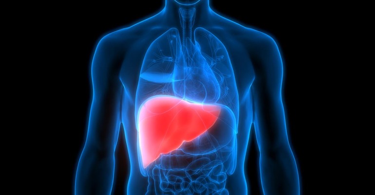 Naczyniak wątroby - przyczyny, objawy, leczenie