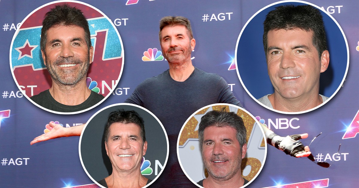 Simon Cowell był uzależniony od medycyny estetycznej. Jak z tym skończył?