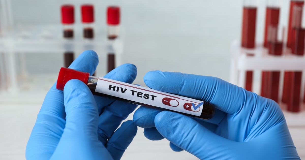 Wirus HIV wciąż groźny. Oto kto najczęściej choruje