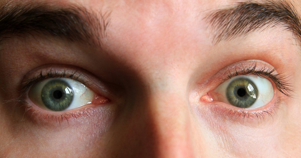 Trypofobia (choroba) - test, przyczyny i objawy. Co to jest - Kobieta