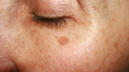 Tizanor - wskazania, działanie, przeciwwskazania