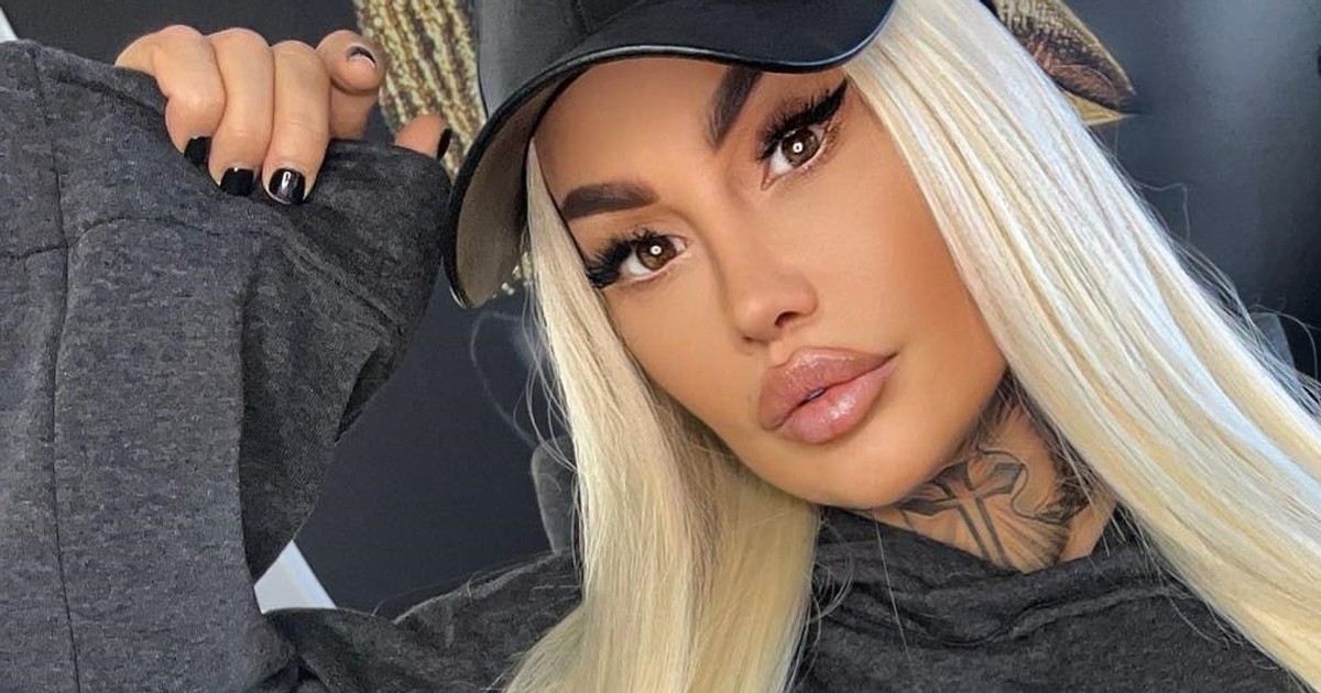 Laluna przeszła operację zmniejszania żołądka. Tyle jest w stanie zjeść