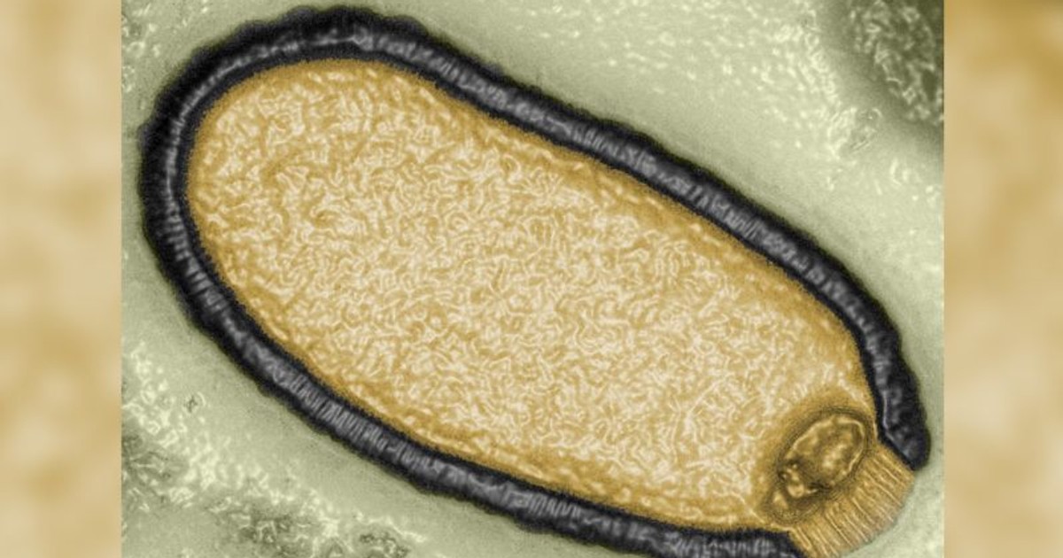 "Wirus zombie" spędził tysiące lat w wiecznej zmarzlinie. Naukowcy go ...