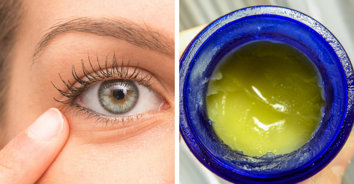 Maść z arniki kosztuje 6 zł w aptece, a działa jak najlepszy krem pod oczy