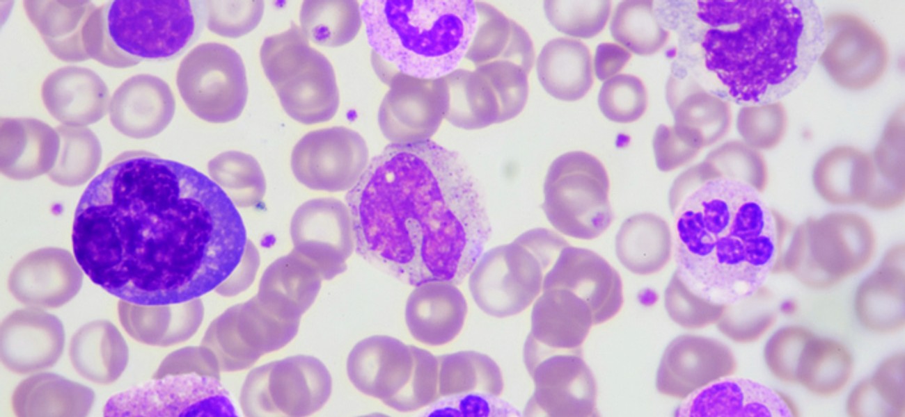 Bazofile - wyniki badań (co oznacza ich obniżony i podwyższony poziom?)