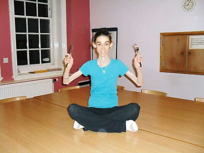 Zmarła 31-letnia anorektyczka. Ważyła tylko...