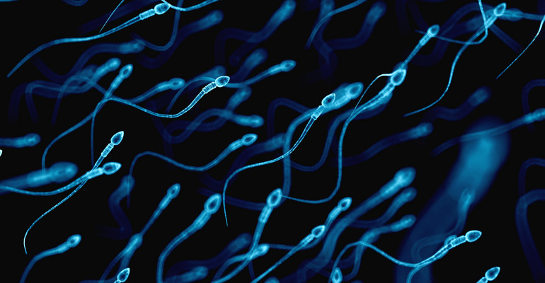 USG jąder i moszny w diagnostyce niepłodności