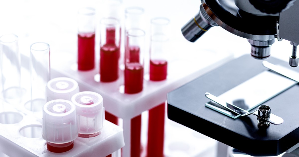 Eozynocyty - to one odpowiadają za odporność immunologiczną. O czym ...