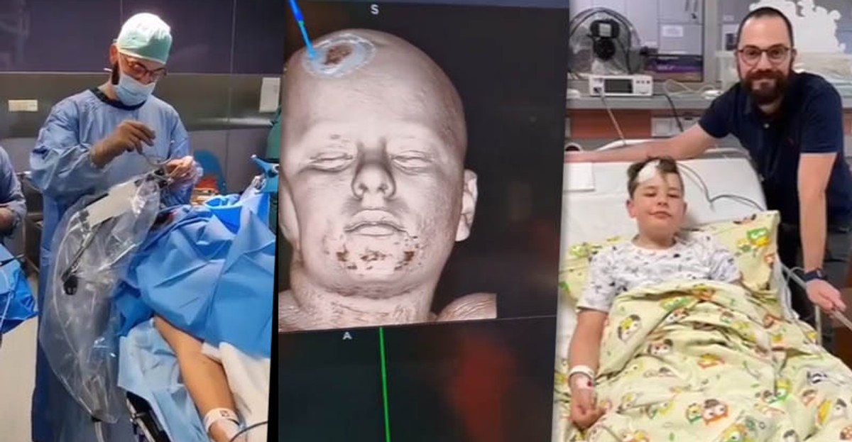 Polscy lekarze usunęli 10-latkowi guza mózgu bez otwierania czaszki. To ...