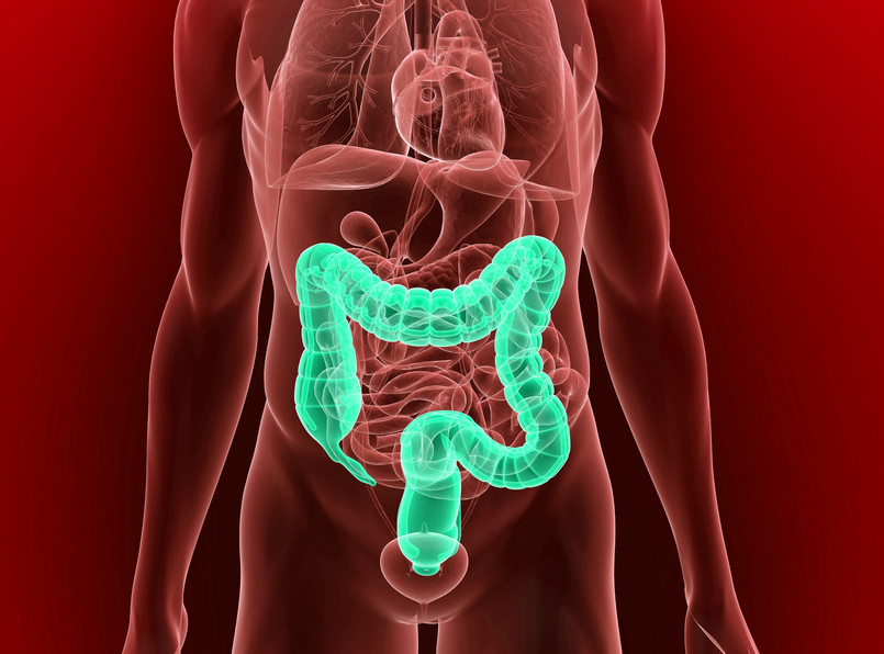 Rak jelita grubego to niemal epidemia w Polsce. Jak zmniejszyć ryzyko ...
