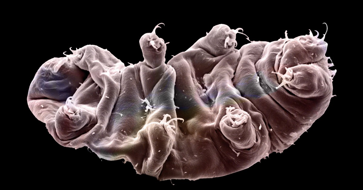 Watch Dr. Pimple Popper Squeeze a 'Bug' Out Of a Neck Cyst | Pulse Nigeria