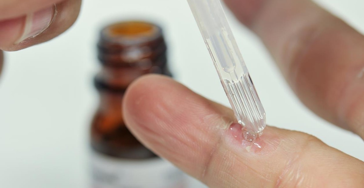 Brodacid - skład, działanie, dawkowanie, działania niepożądane