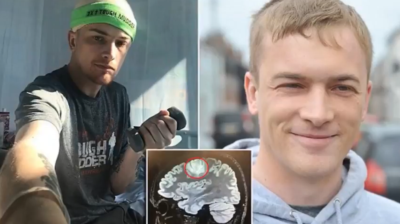 DUPLI ŠOK Imao je tumor na mozgu veličine JAJETA, ali to nije NAJGORA ... DUPLI ŠOK Imao je tumor na mozgu veličine JAJETA, ali to nije NAJGORA ...