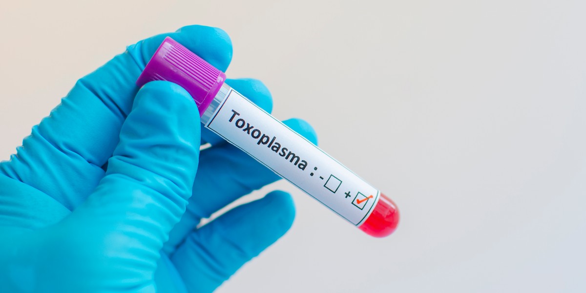 Toksoplazmoza: co to, objawy, źródło zakażeń, leczenie, ciąża - Kobieta