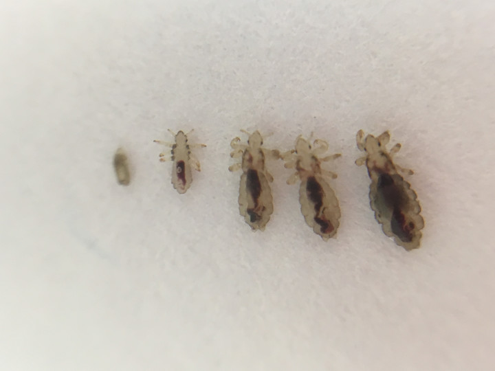 Ewa profesjonalnie usuwa wszy. Dorośli się wstydzą, a dzieci... wpadają ...