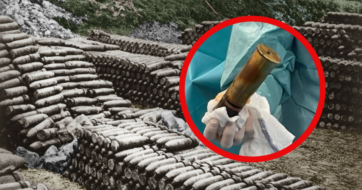 88-latek wetknął w odbyt... pocisk artyleryjski z I wojny światowej ...