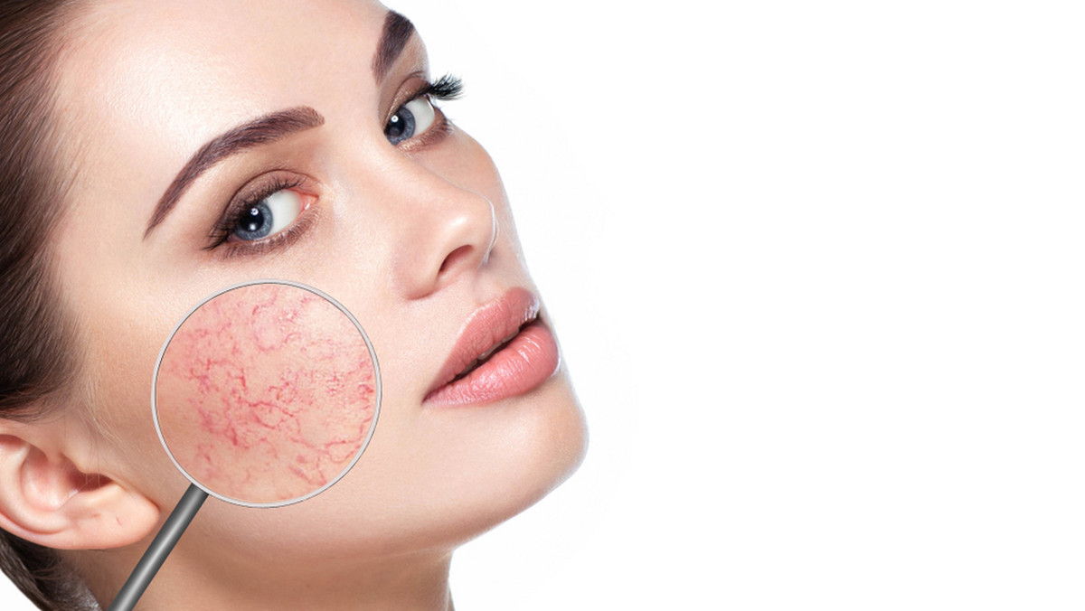 Jakie są rodzaje skóry i jak sprawdzić jaki mamy typ cery? - Uroda