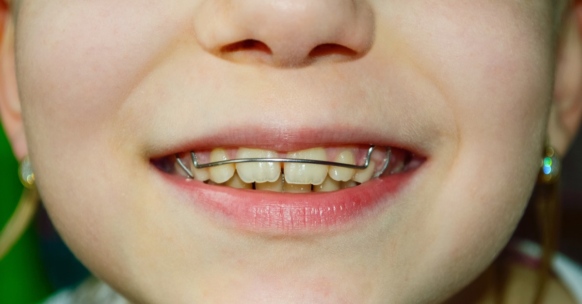 Czym jest retrogenia?