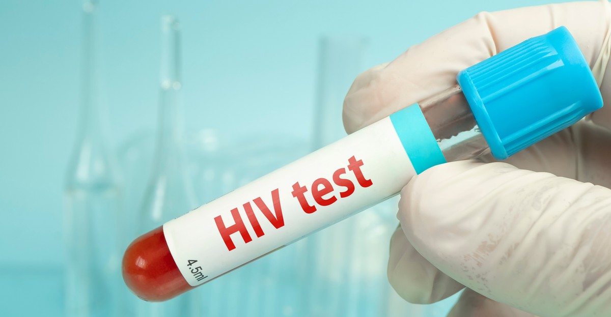 Nowy zastrzyk zapewnia pełną ochronę przed HIV. "Rewolucyjna wiadomość"